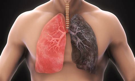 Study Shows Potential Of Stem Cell Therapy To Repair Lung Damage