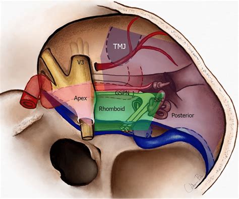 Temporal Bone Petrous Part Anatomy Photo Showing The General