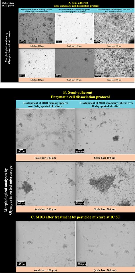 Shotgun Proteomic Based Approach With A Q Exactive Hybrid Quadrupole Orbitrap High Resolution