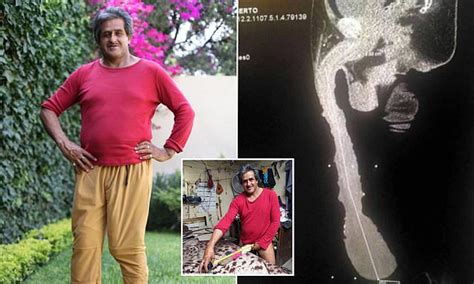 World Longest Pennis Man With Worlds Longest Penis Now Registered As