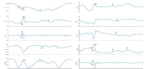 Figure 2 From Accurate Estimation Of Running Temporal Parameters Using Foot Worn Inertial