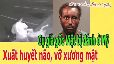C ụ gi à gốc Việt b ị đ á nh ở Mỹ X u ấ t h u y ế t n ã o v ỡ x ư ơ ng m ặ t YouTube