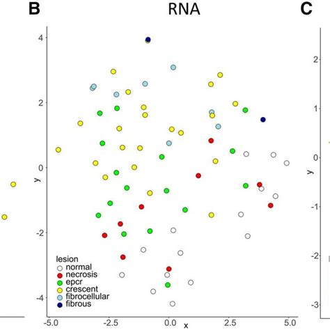 Dsp Indicates Clustering Of Morphological Lesion Groups By Gene Or