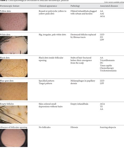 Table 2 From Histological And Trichoscopic Correlations In Scalp Disorders Semantic Scholar