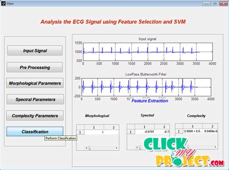 Detection Of Life Threatening Arrhythmias Using Feature Selection And Support Vector Machines