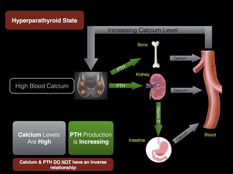 Diagnosis Hyperparathyroidism Surgery Dr Babak Larian