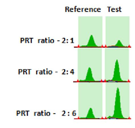 An Example Of A Genemapper® Electropherogram Showing The Test Locus And Download Scientific