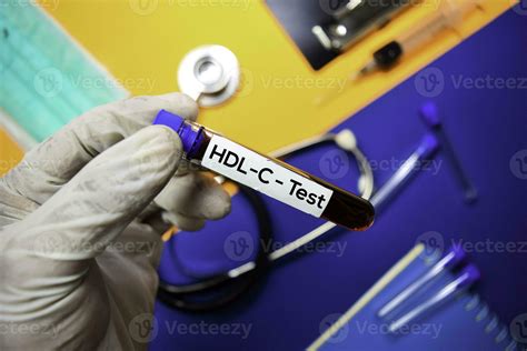 HDL C Test With Blood Sample Top View Isolated On Color Background Healthcare Medical Concept