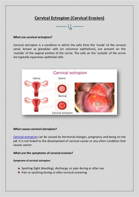 Cervical Ectropion Causes Symptoms Cervical Ectropion