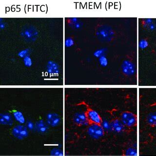 Representative Images From Cerebral Cortex Of A Control Mouse And One Download Scientific