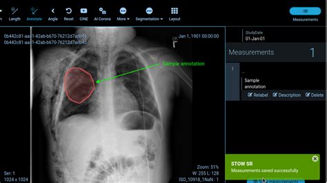 How To Save Measurements And Annotations For A DICOM Hosted In Orthanc Issue OHIF