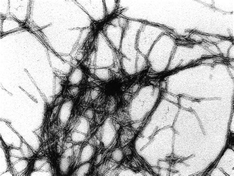 Fluorescence Anisotropy Experiments A Anisotropy Decay Of A40