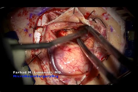 Major Project Anomaly Detection Roboflow Universe