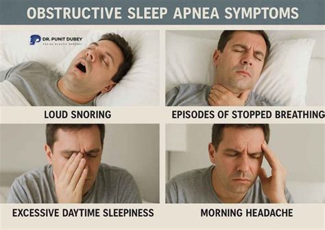 Jaw Surgery For Obstructive Sleep Apnea Treatment In Delhi
