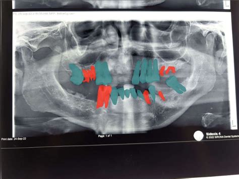 Pin By Maruful Islam On Data Labeling Data Annotation Data Tagging Annotation Data Tags