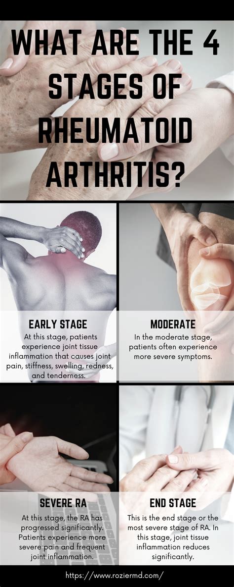 Therapy For Rheumatoid Arthritis In The Hand 60 Off
