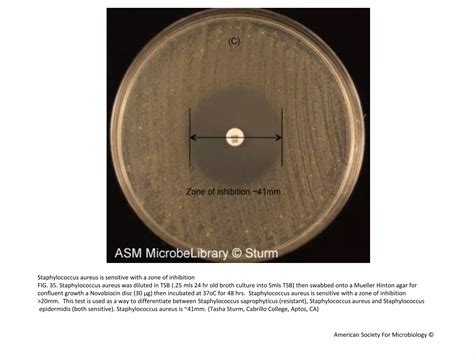 Kirby Bauer Disk Diffusion Susceptibility Test Pptx