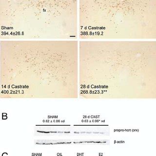 Weak With Sex Sexual Intercourse As A Trigger For Cataplexy Request PDF