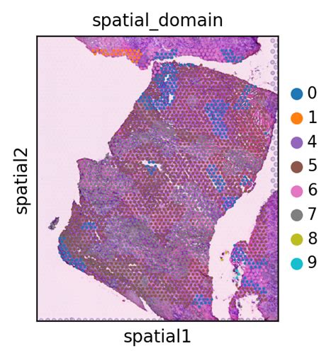 Splane Tutorial Identification Of Uniform Spatial Domain On Human Breast Cancer Visium Dataset