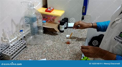 Female Hand Collecting Urine Sample At Laboratory Editorial Stock Image Image Of Center Case
