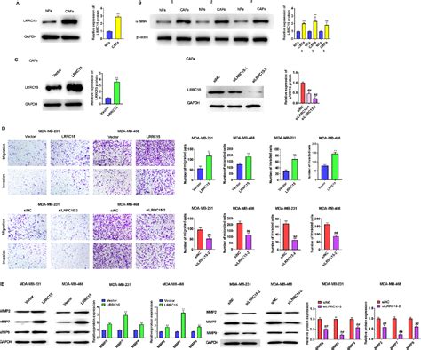 Figure 1 From Cancer Associated Fibroblast Derived Lrrc15 Promotes The Migration And Invasion Of