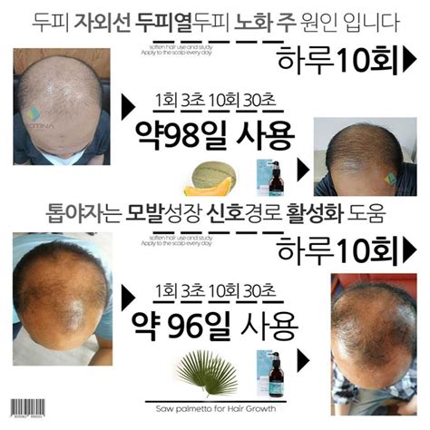 수유눈썹문신 수유두피문신 수유속눈썹 수유네일 수유미용실 수유붙임머리 Naebutelwabonfall • Instagram