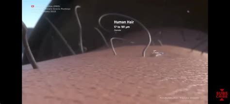 Video Abhishek Bharti On Linkedin Microbiologymeetsmanagement Shapingmicrobialfuture