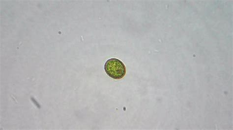 Algae Under Microscope 100x