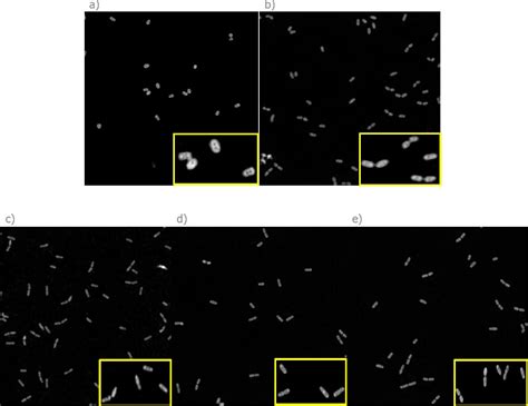 Yeast Morphology Assays Using Label Free Live Cell Imaging