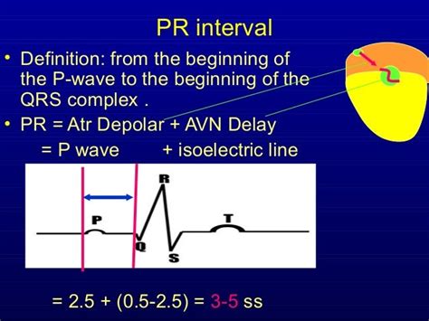 2nd Part Ecg Basics Pr Interval And Heart Block