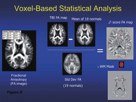 Schematic Of Voxel Based Statistical Analysis Patient S Spatially Download Scientific Diagram