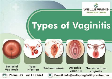 Wellspringfertilitycenter Ivf Infertility Ivf Fertility Ttc Infertilityawareness Pcos