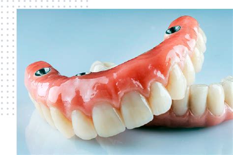 PrÓtesis Y RehabilitaciÓn Oral Ao Hortz Klinika