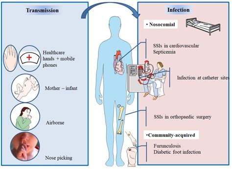 Staphylococcus Nose Symptoms And Treatment Options Explained