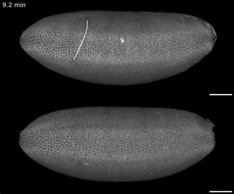 Deo S2 Dynamics Of Ectopic Folding In Btd Mutant The Cephalic Furrow Download Scientific