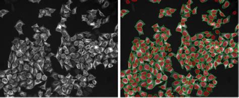 20 Examples Of Effortless Nucleus And Cell Segmentation Using Pretrained Deep Learning Models