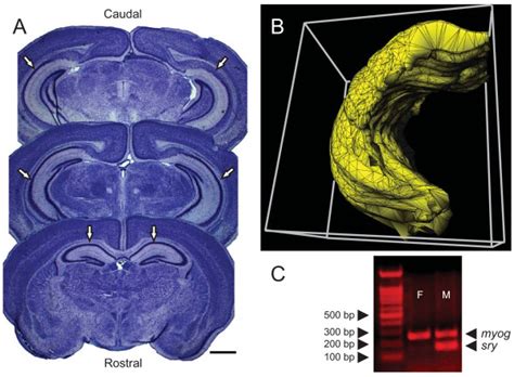 Three Dimensional Reconstruction Of The Hippocampal Complex And Download Scientific Diagram