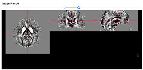 Update Contrastwindowing Interactively · Issue 645 · Niivueniivue · Github