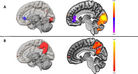 Dorsal Attention Network A And Fronto Parietal Network B Download Scientific Diagram