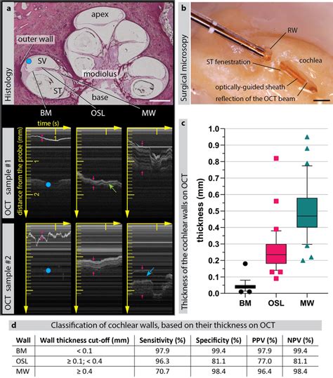 Thickness Based Identification Of The Cochlear Walls With The