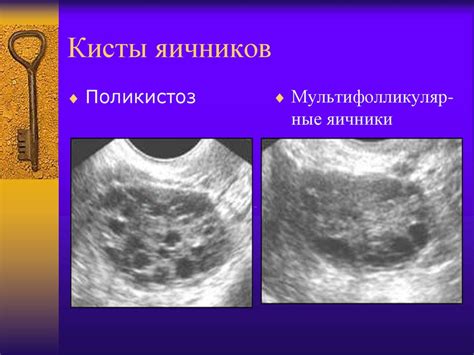 Ультразвуковая диагностика в гинекологии презентация онлайн