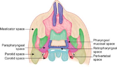 Infratemporal Space Displacement Tooth
