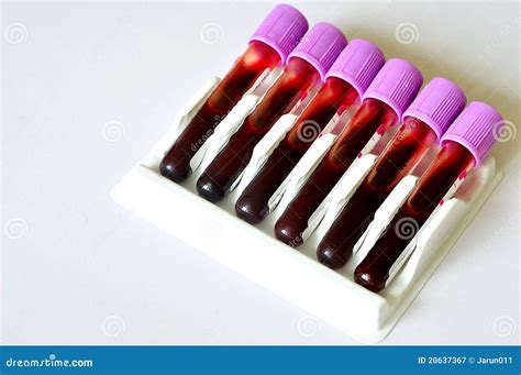 Blutprobe Stockbild Bild Von Kontrolle Experiment Gesundheit 20637367