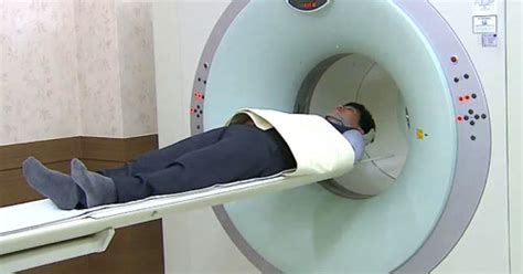 노인성 뇌질환 파킨슨병 40~50대 환자 급증