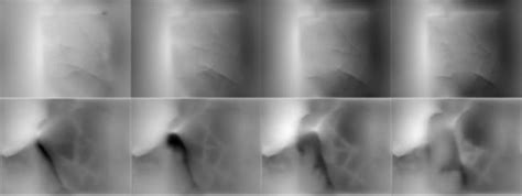 Comparison Of V After Using Varying Illumination Optical Flow Method