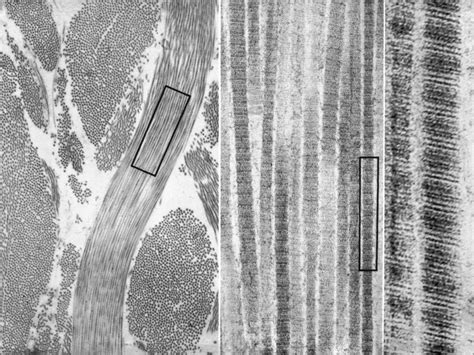 The Structure And Function Of Collagen Hubpages