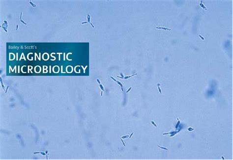 نمای کلنی و میکروسکوپی فرم رشته ای و مخمری گونه های اسپوروتریکس Sporothrix Spp آزمایشگاه