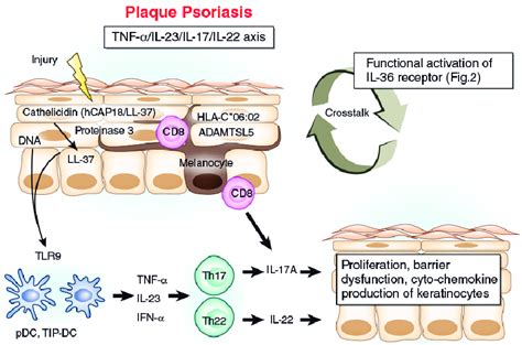 Pathogenesis Of Plaque Psoriasis Psoriatic Lesions Are Frequently