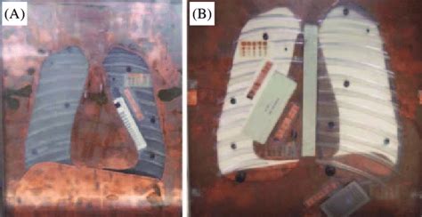 Chest Phantom With Simulation Of Nodules In Variable Positions Of Download Scientific