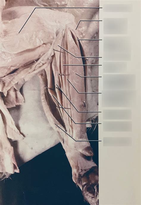 Superficial Forearm Flexors Diagram Quizlet